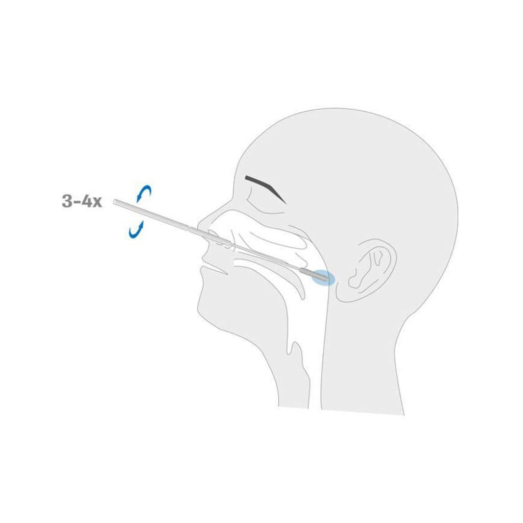 SARS-CoV-2 Rapid Antigen Test - Nine Elms Clinic
